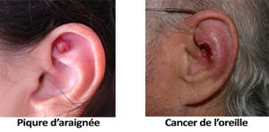 Anatomie de l'oreille - ORL Nice Dr Laurent Tardivet Chirurgien ORL